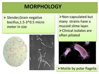 family :Pseudomonadaceae & Legionellaceae | PPT