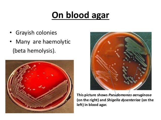 Pseudomonas Aeruginosa On Macconkey Agar