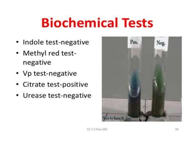 Urease Test For Pseudomonas Aeruginosa
