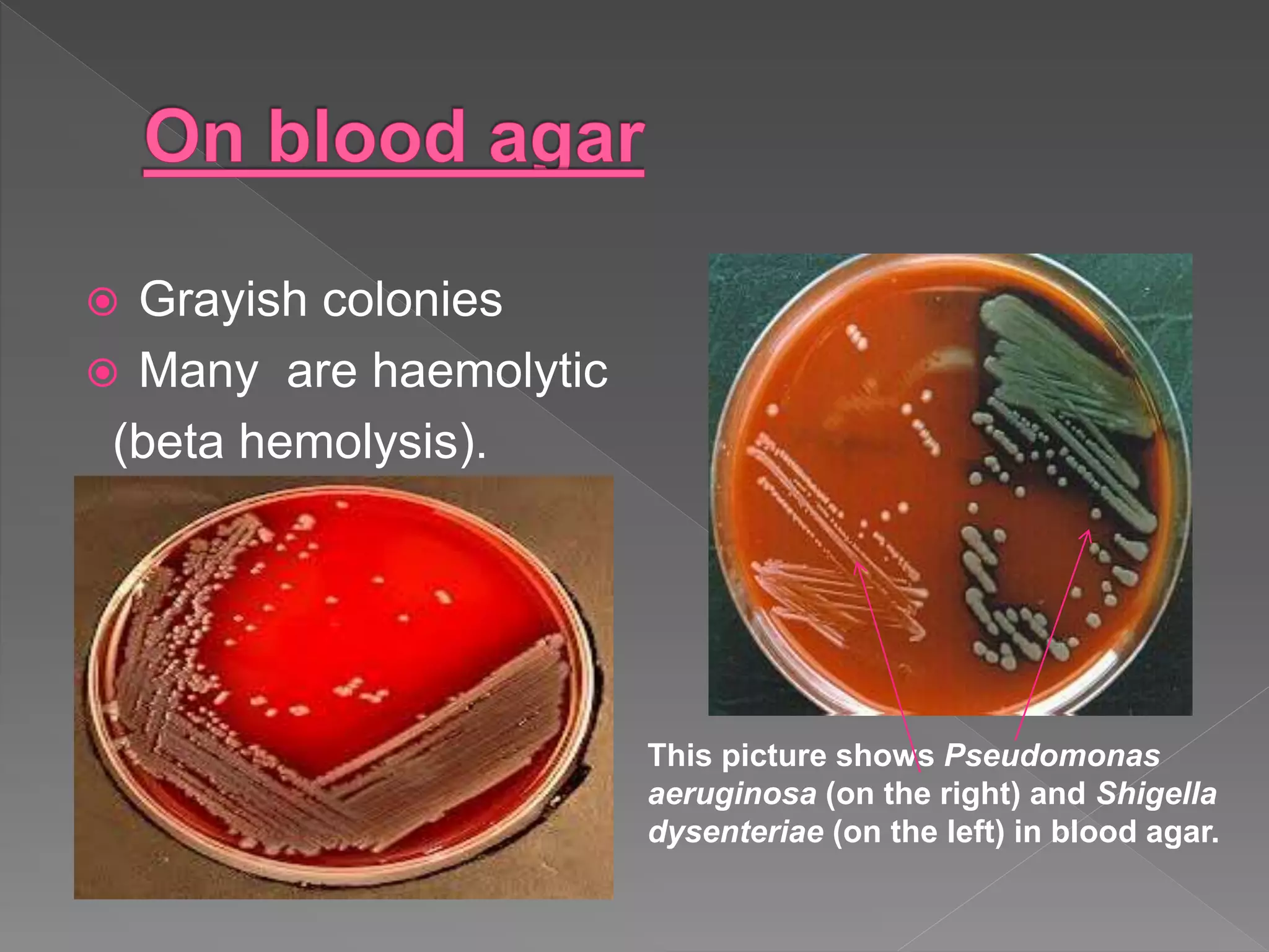 pseudomonas-161203195049.pdf