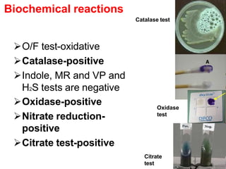 pseudomonas- caractères marphologi.pptx