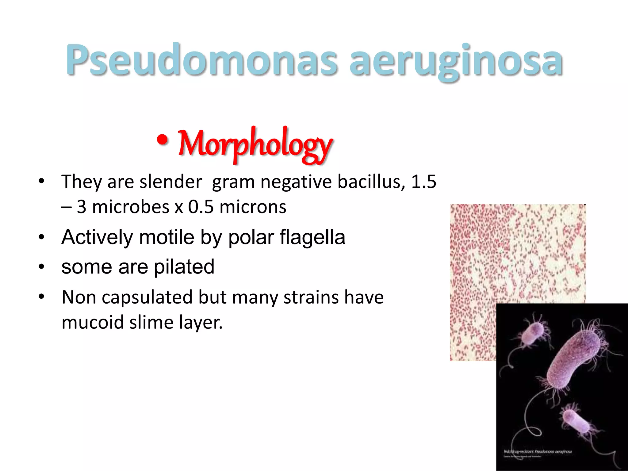 Pseudomonas | PPTX
