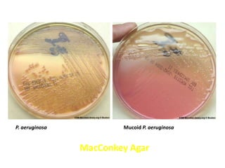 Pseudomonas Aeruginosa On Macconkey Agar