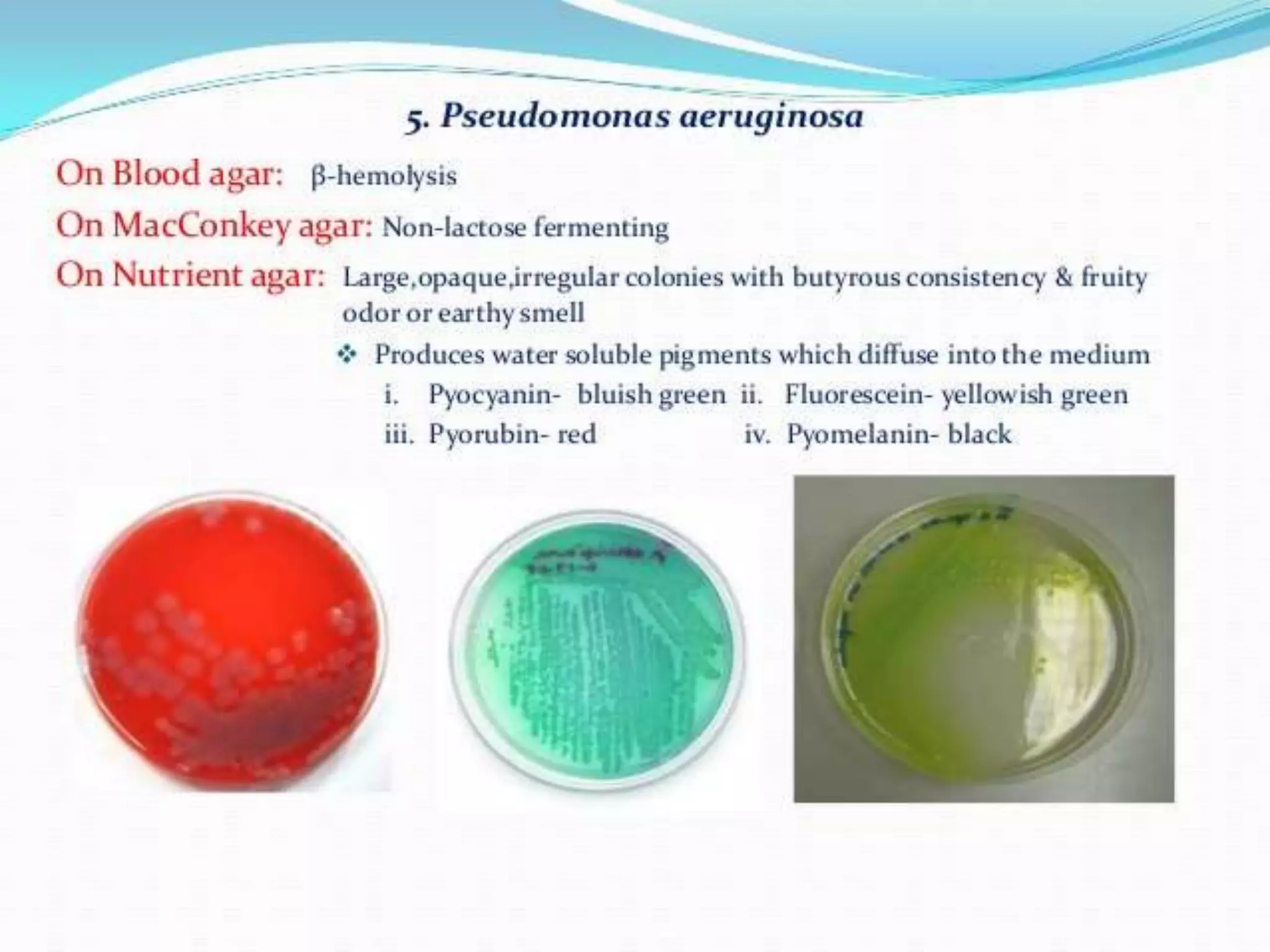 pseudomonas.pptx