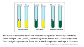 Pseudomonas aeruginosa gram negative bacilli | PPT | Free Download