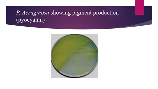 pseudomonas aeruginosa - medical bacteriology | PPT