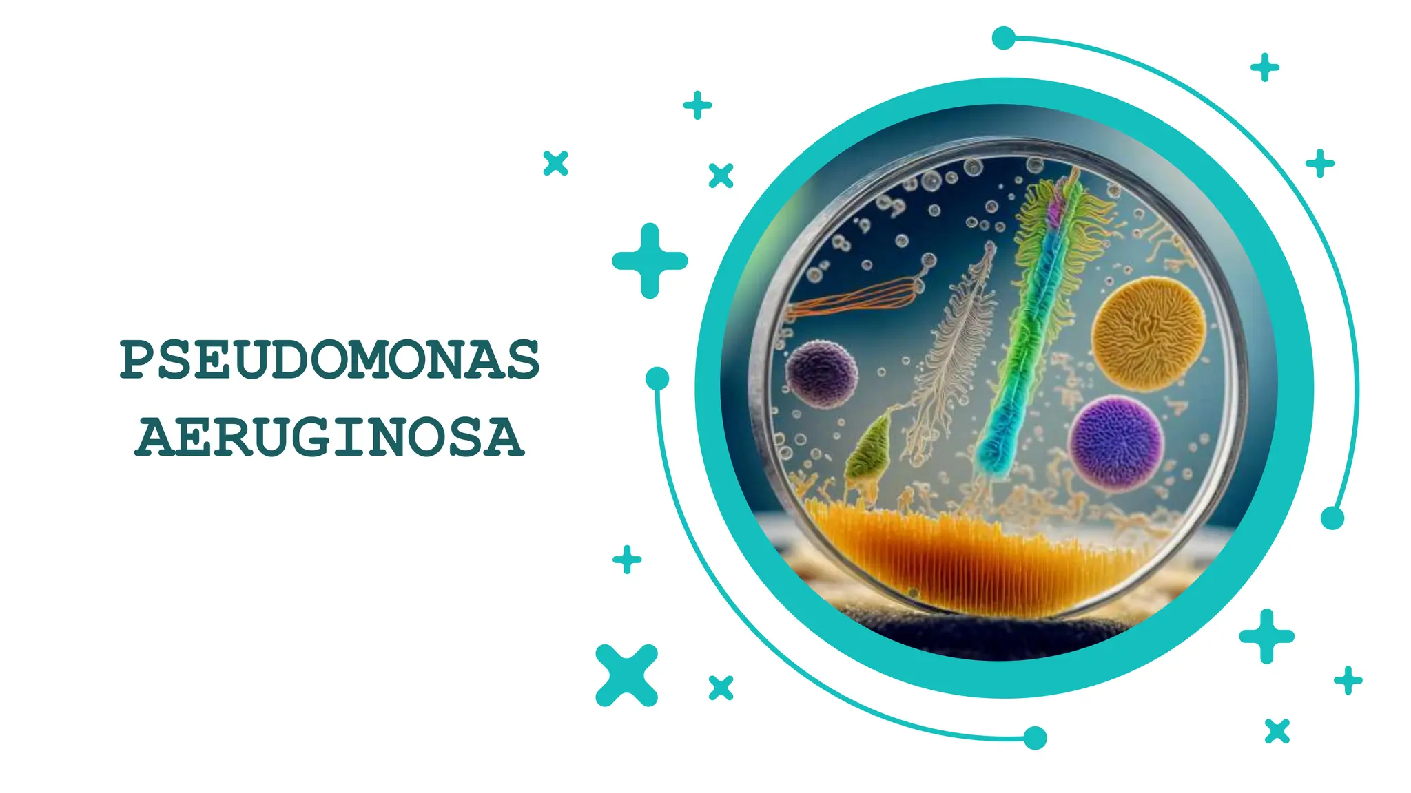PSEUDOMONAS AEROGINOSA .pptx