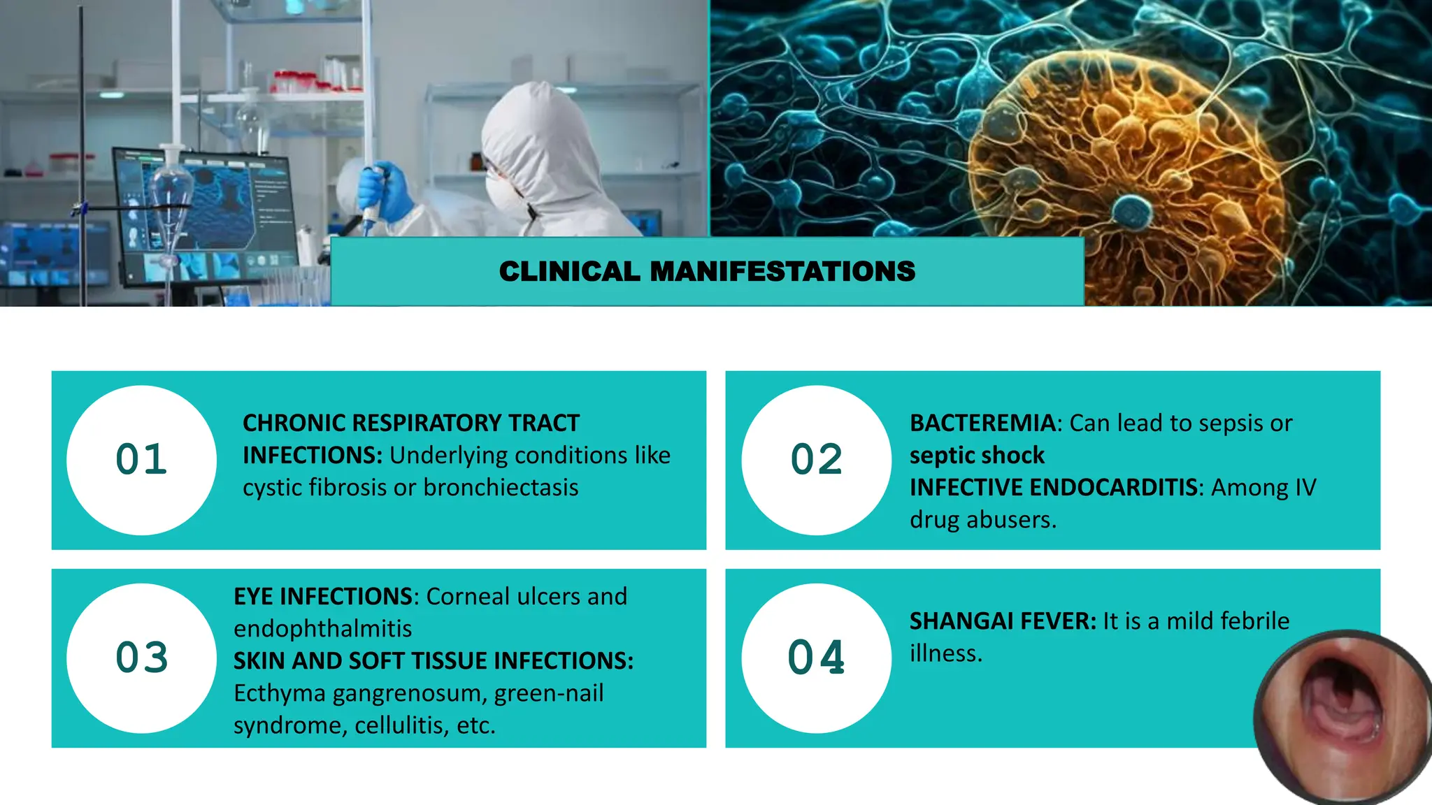 PSEUDOMONAS AEROGINOSA .pptx