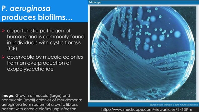 Pseudomonas aeruginosa mini-presentation | PPTX