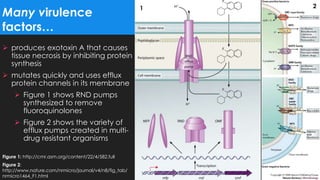 Pseudomonas aeruginosa mini-presentation | PPTX