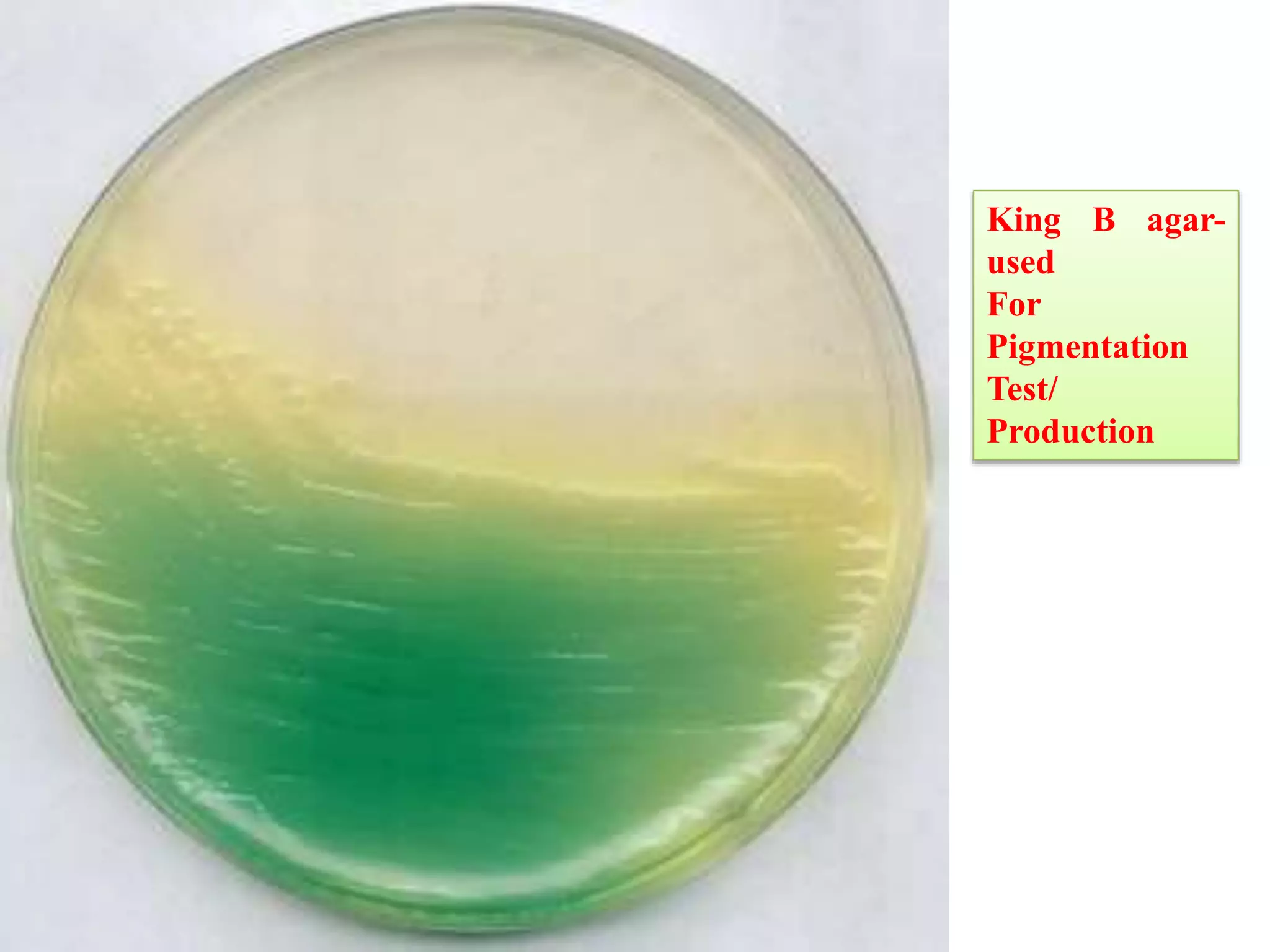 Pseudomonas aeruginosa | PPTX