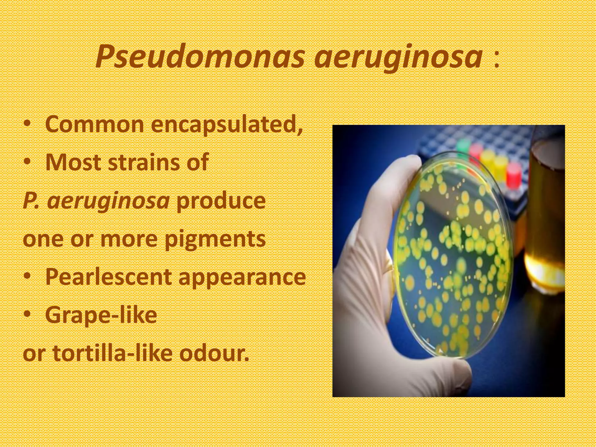 Pseudomonas aeruginosa.. | PPTX