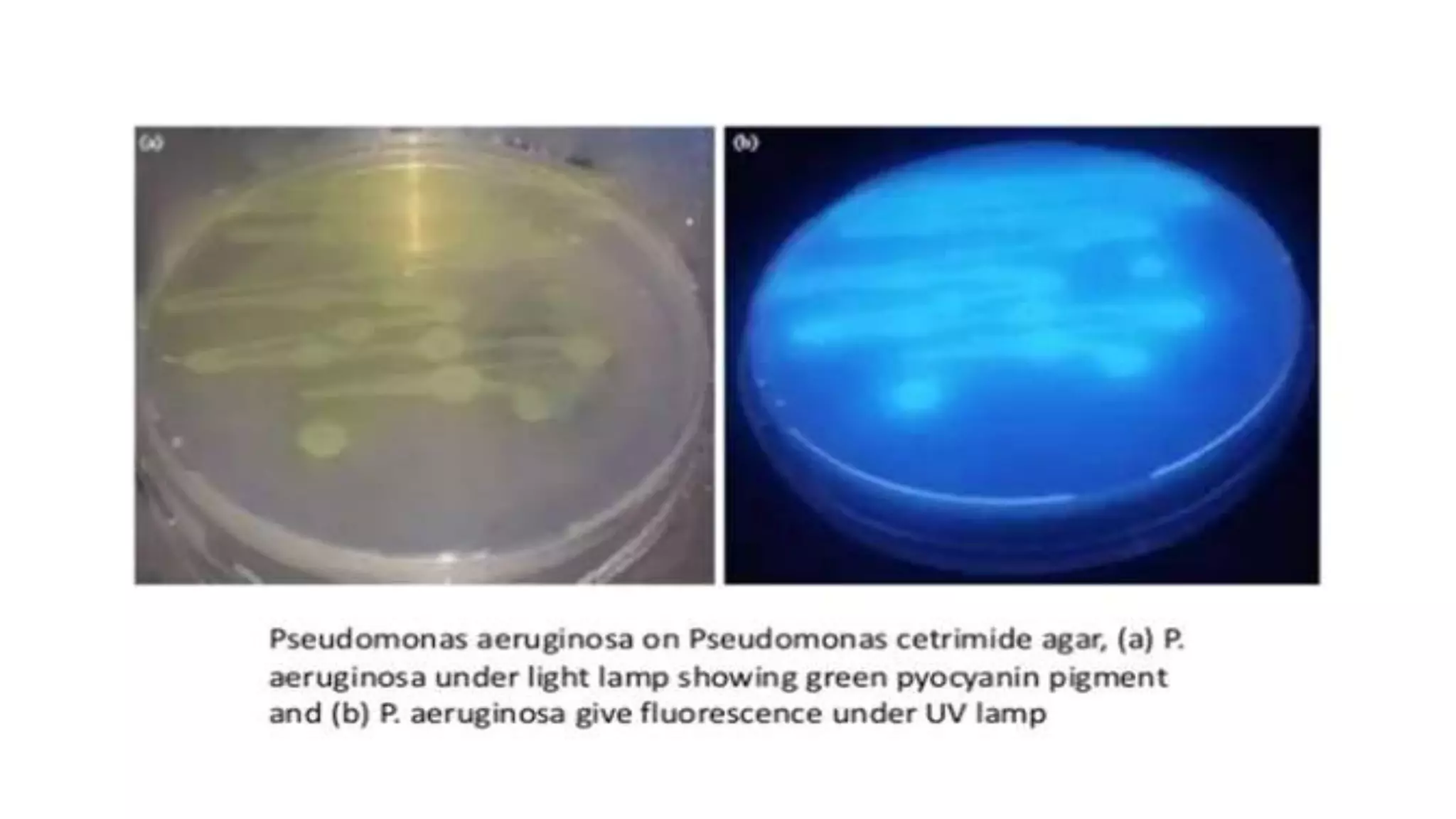 Pseudomonas aeruginosa-M | PPTX