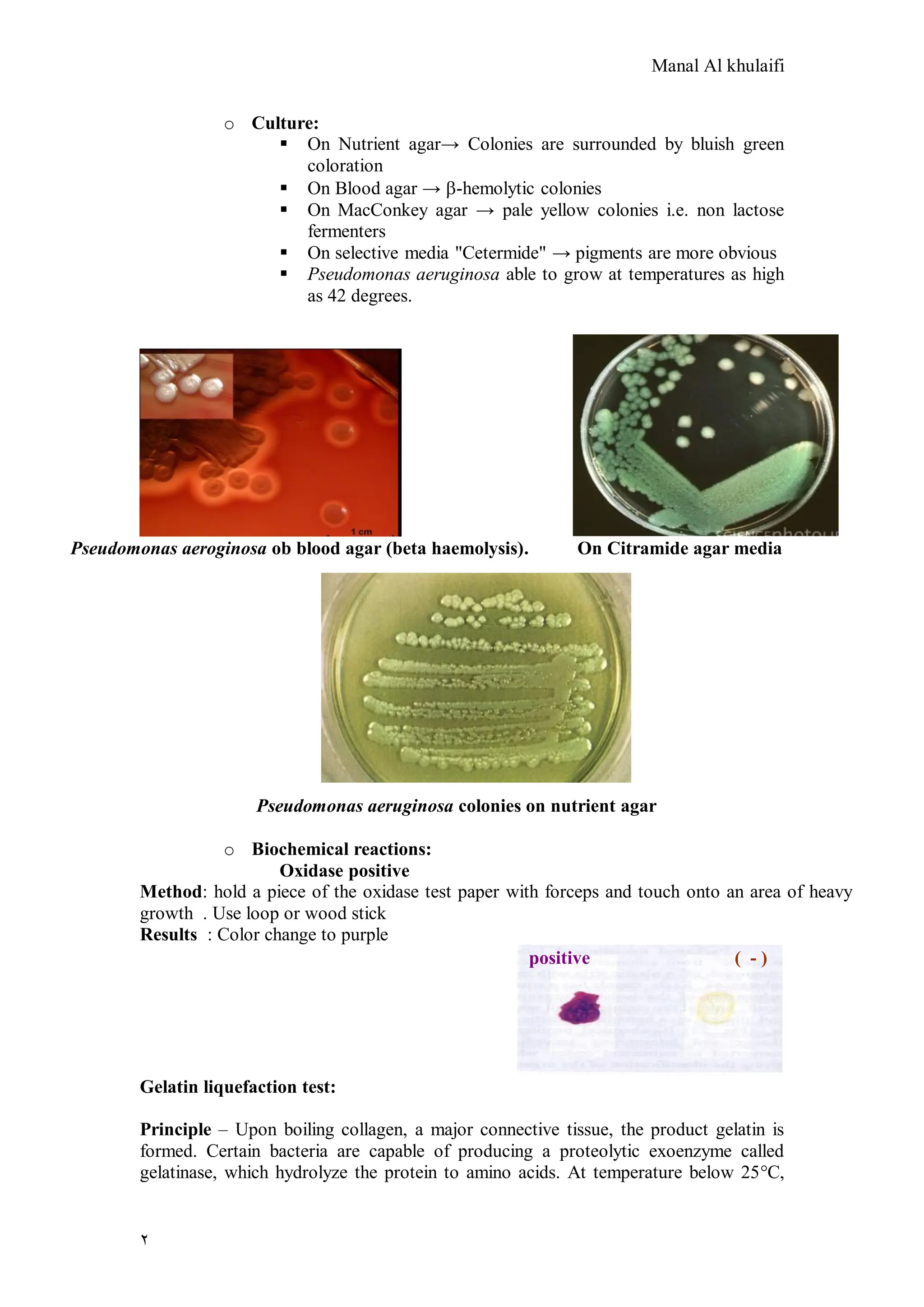 Pseudomonas aeruginosa Characteristics and Culture | PDF