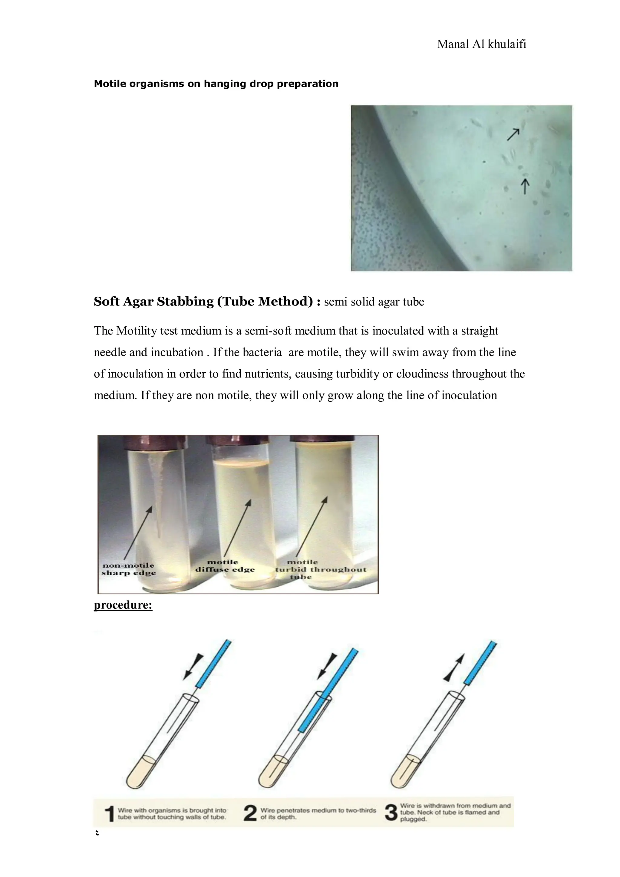 Pseudomonas aeruginosa Characteristics and Culture | PDF