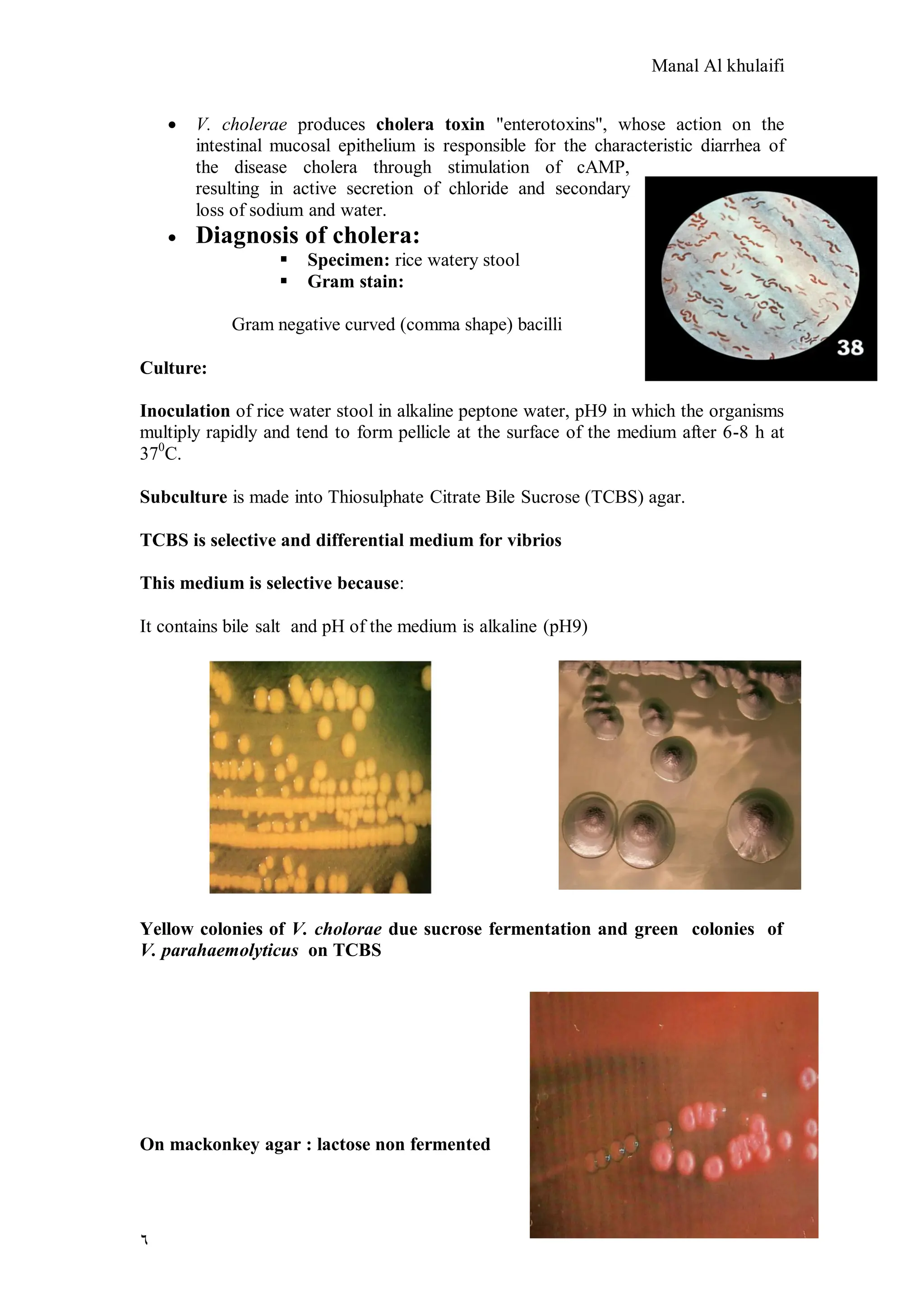 Pseudomonas aeruginosa Characteristics and Culture | PDF
