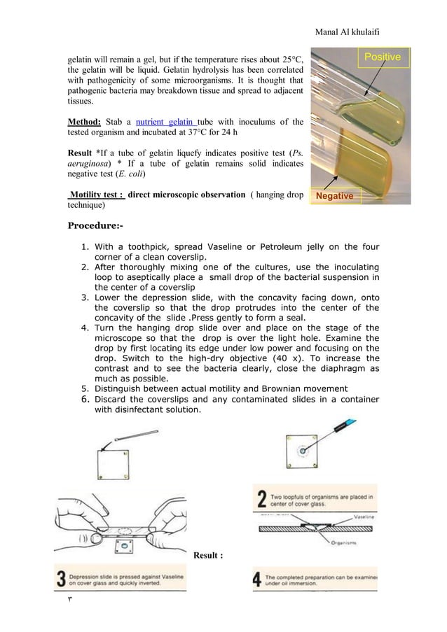 Pseudomonas aeruginosa Characteristics and Culture | PDF