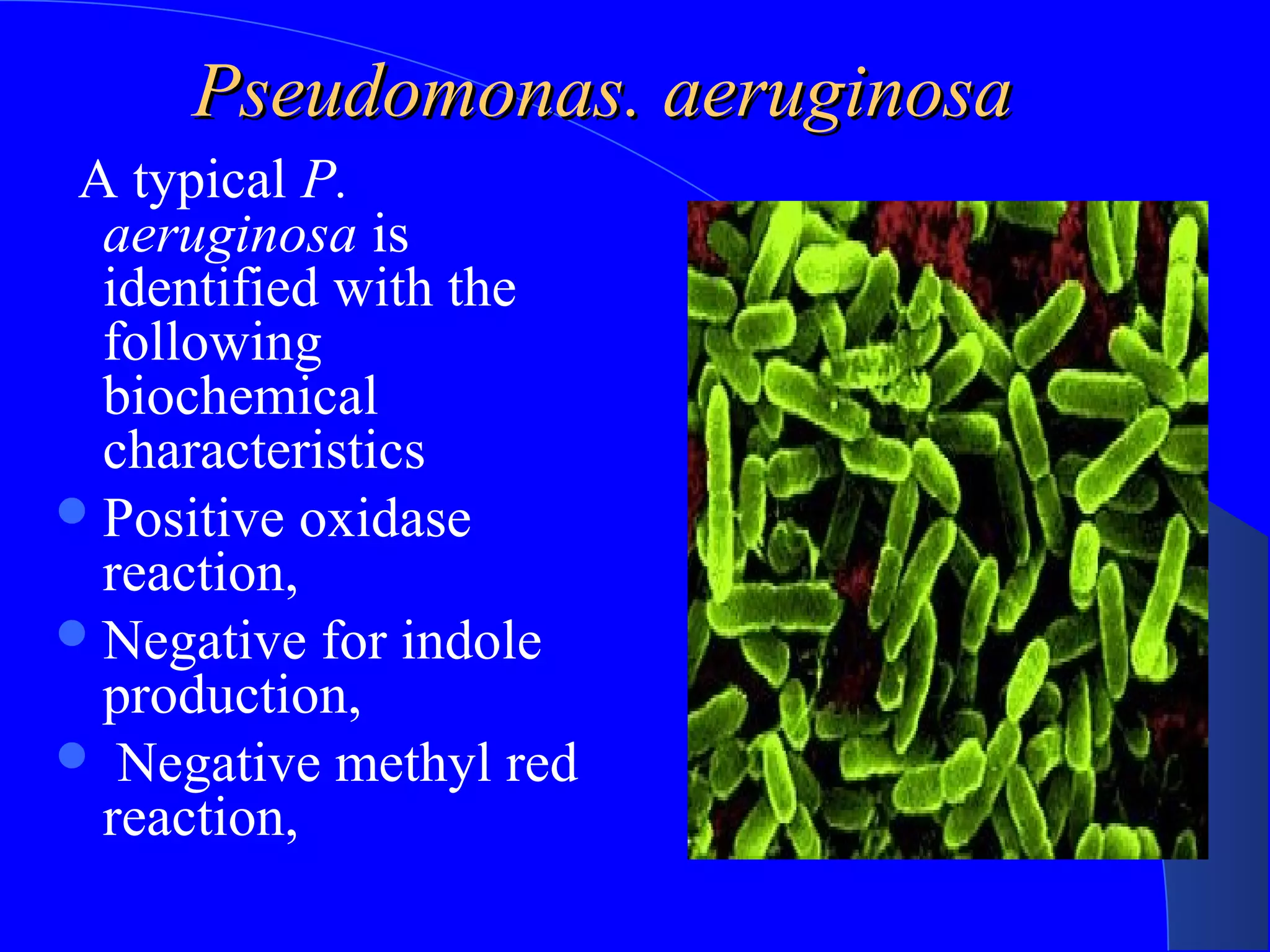 Pseudomonas aeruginosa an epitome of a drug resistance in bacteria | PPT