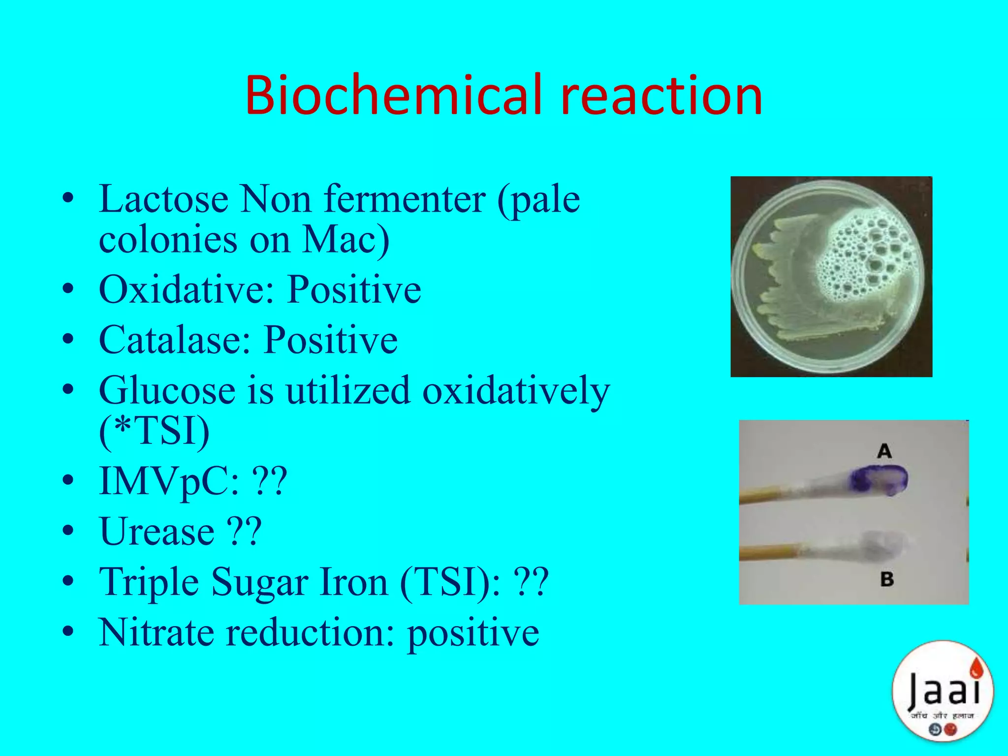 Pseudomonas aeruginosa [autosaved] | PPTX