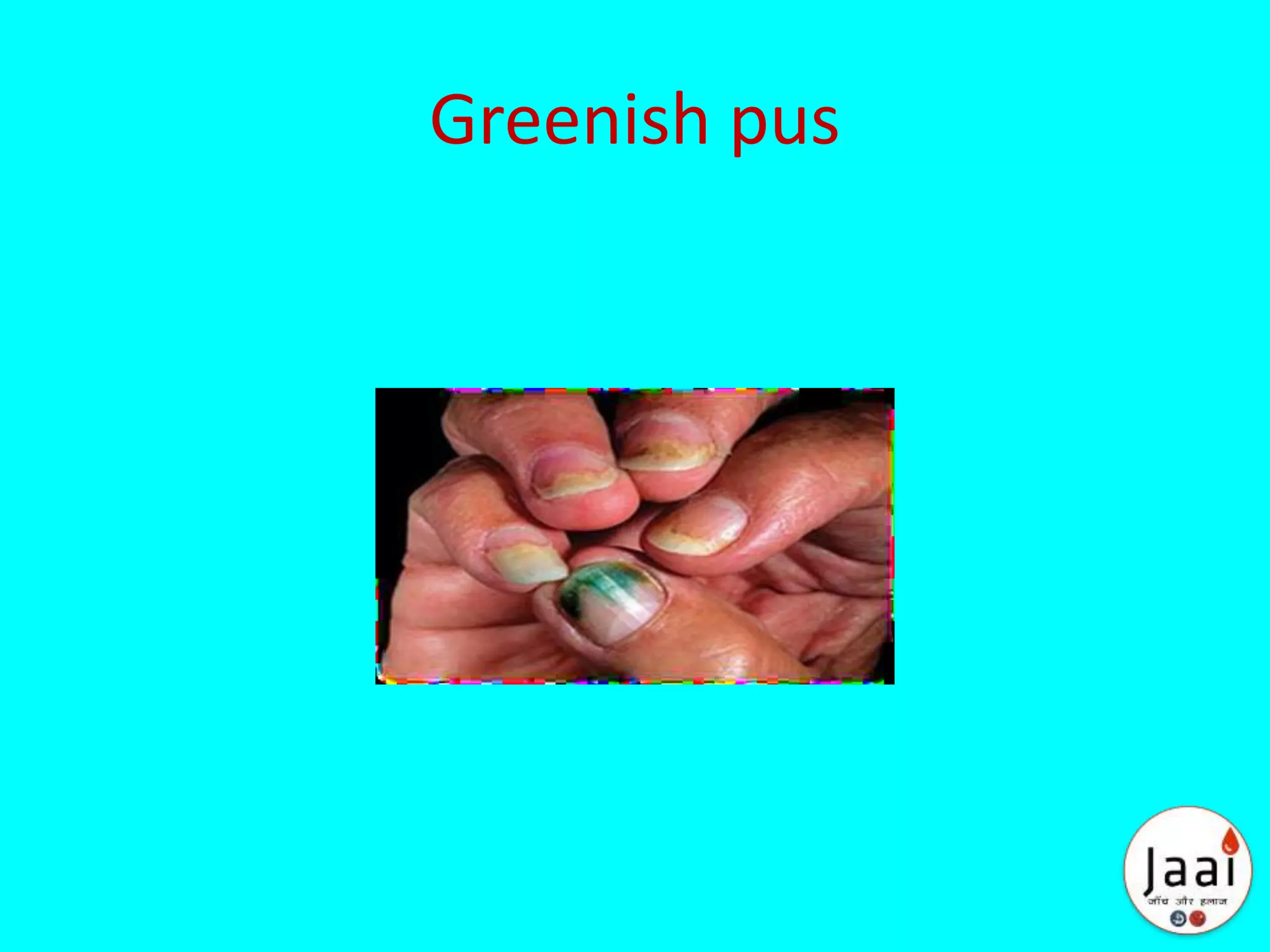 Pseudomonas aeruginosa [autosaved] | PPTX