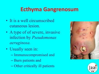 Pseudomonas aeruginosa [autosaved] | PPTX