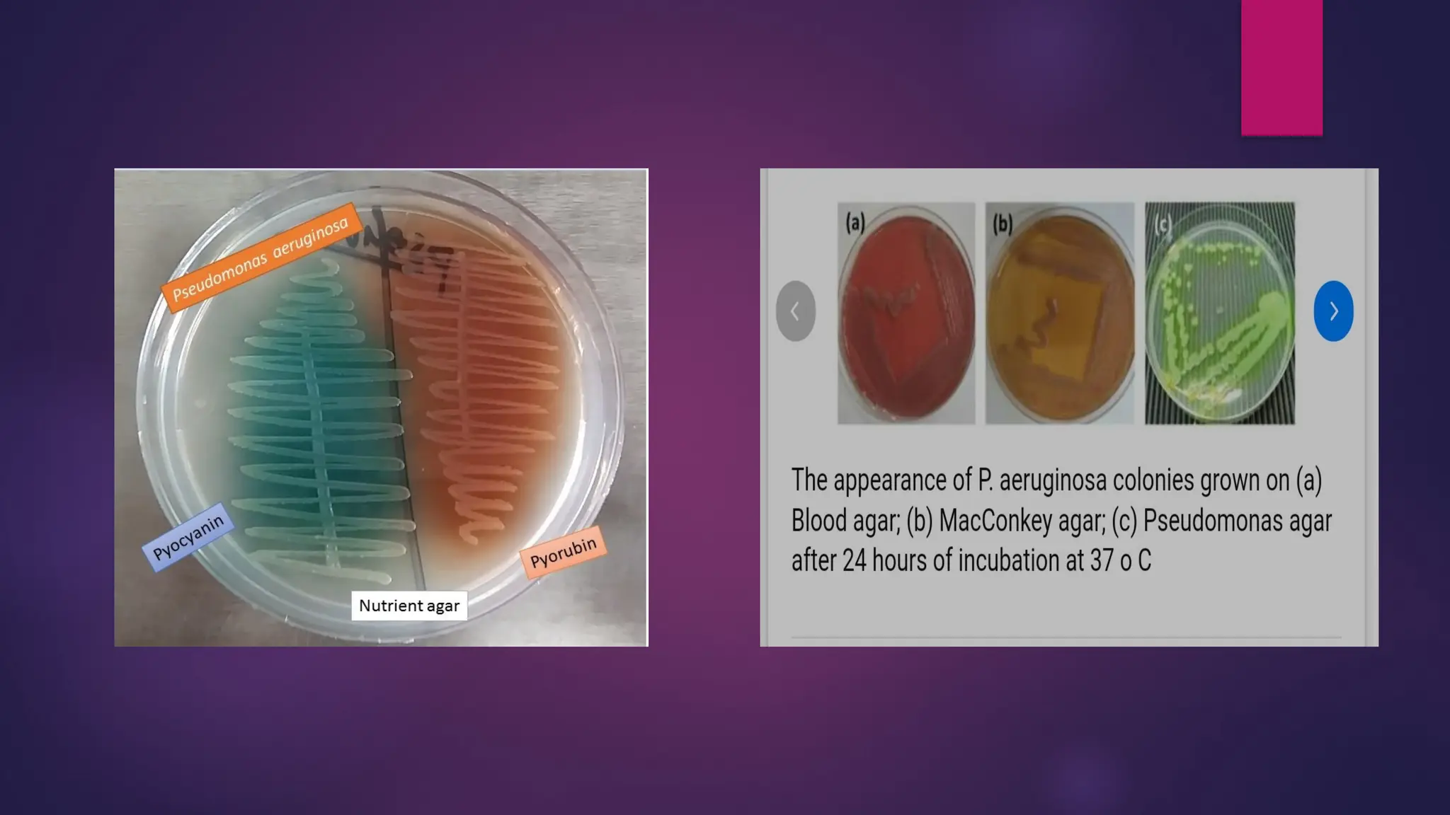 Pseudomonas aeruginosa original .pptx pptx | PPT