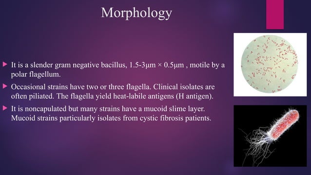 Pseudomonas aeruginosa original .pptx pptx | PPT