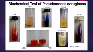 Pseudomonas aeruginosa original .pptx pptx | PPT