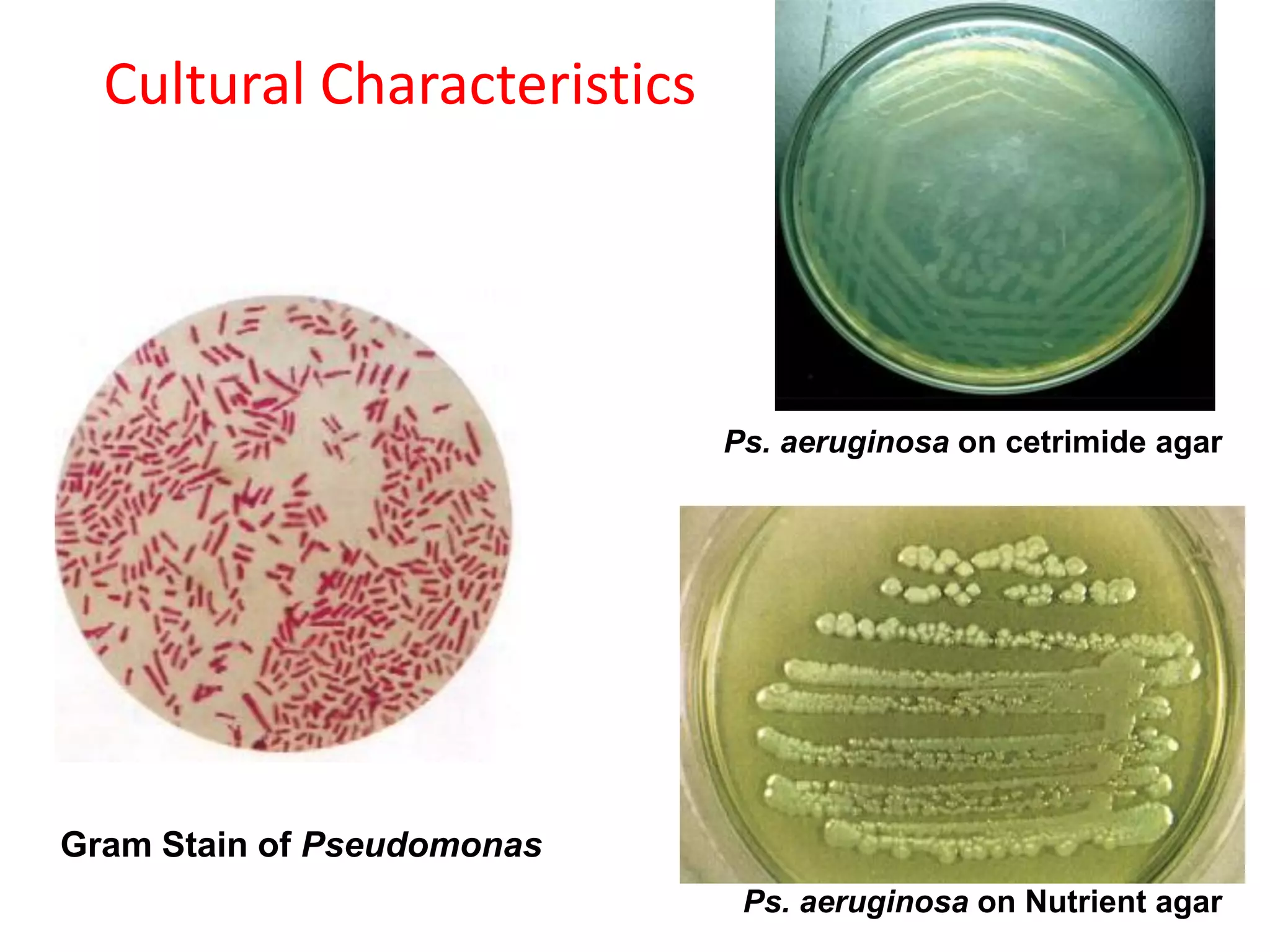 Pseudomonas and nonfermenters (biochemical)بكتريا عملي | PDF