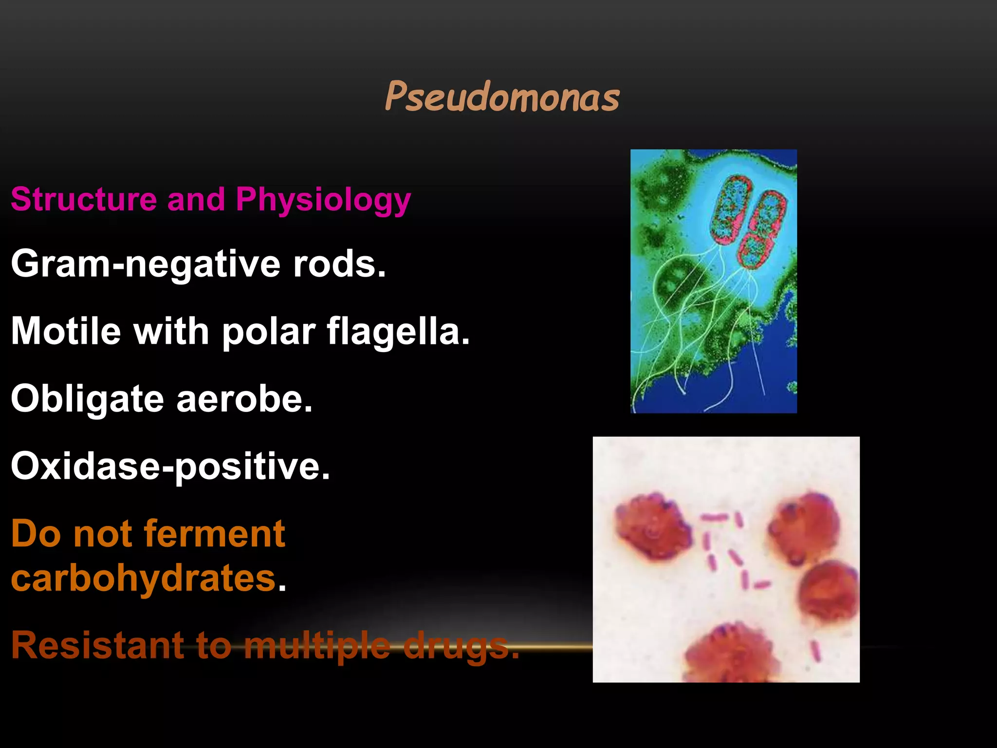 Pseudomonas dr.ihsan alsaimary | PPT