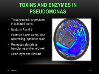 Pseudomonas dr.ihsan alsaimary | PPT