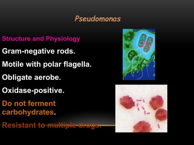 Pseudomonas dr.ihsan alsaimary | PPT