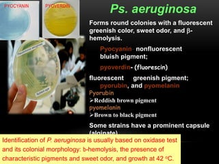 Pseudomonas dr.ihsan alsaimary | PPT