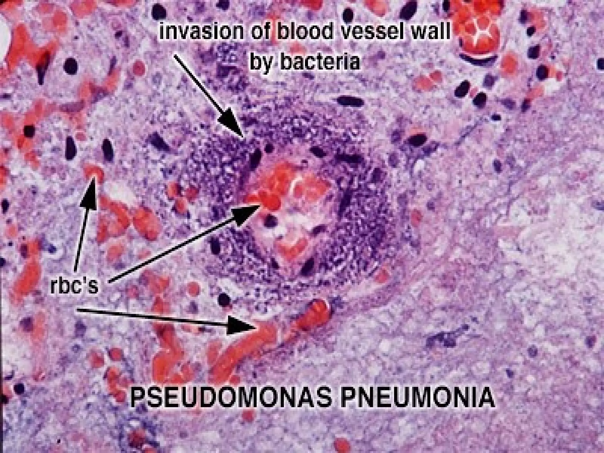 Pseudomonas fi | PPT