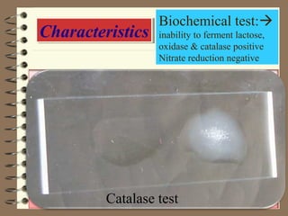 Pseudomonas fi | PPT