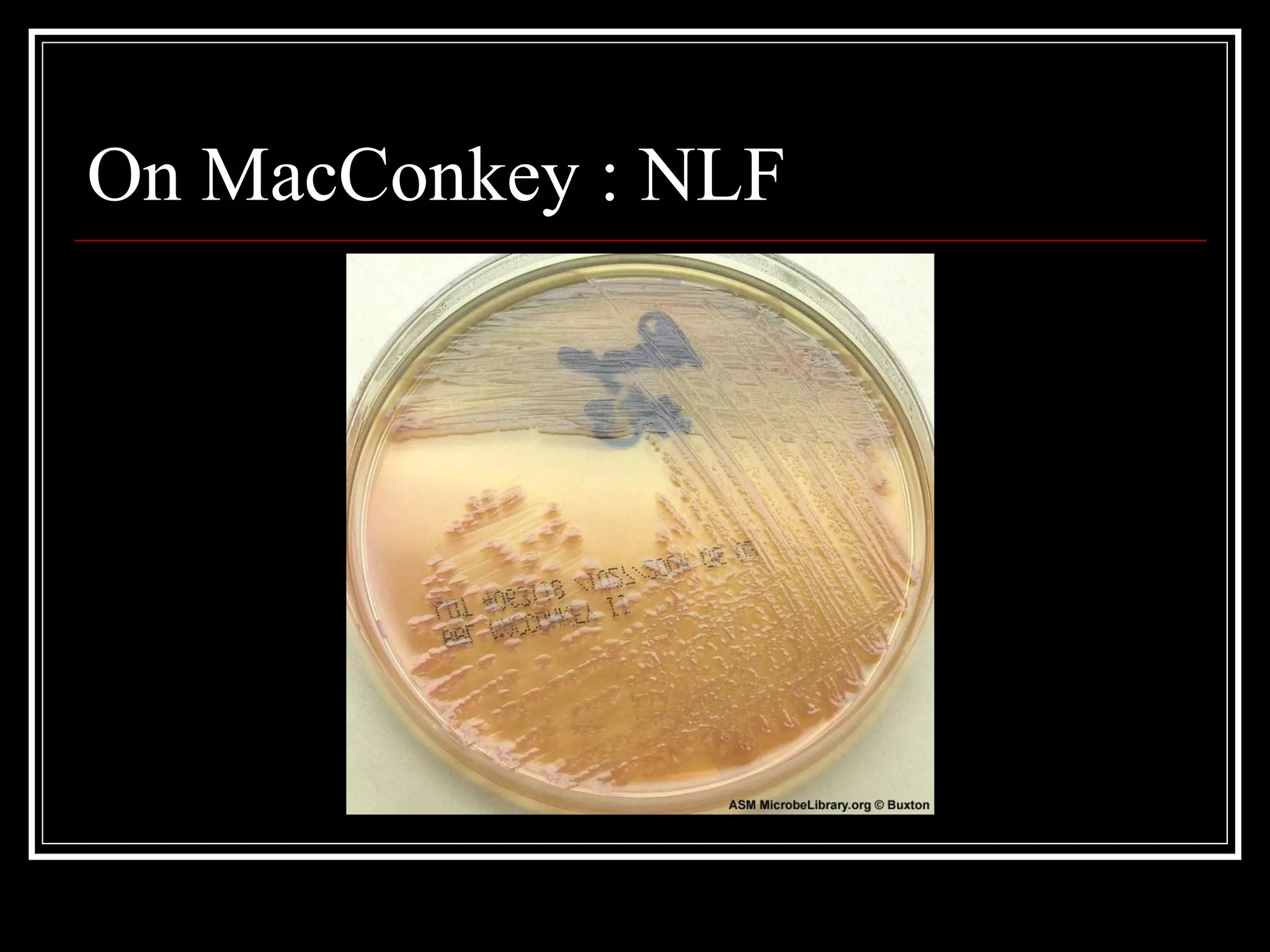 Pseudomonas mahadippt | PPT