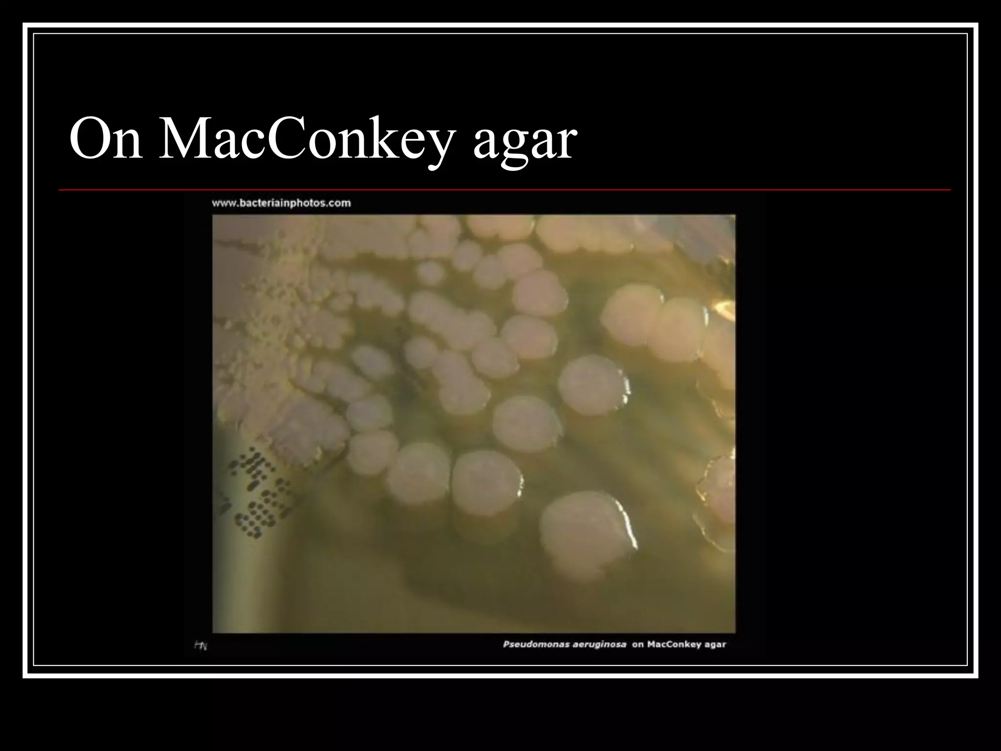 Pseudomonas mahadippt | PPT