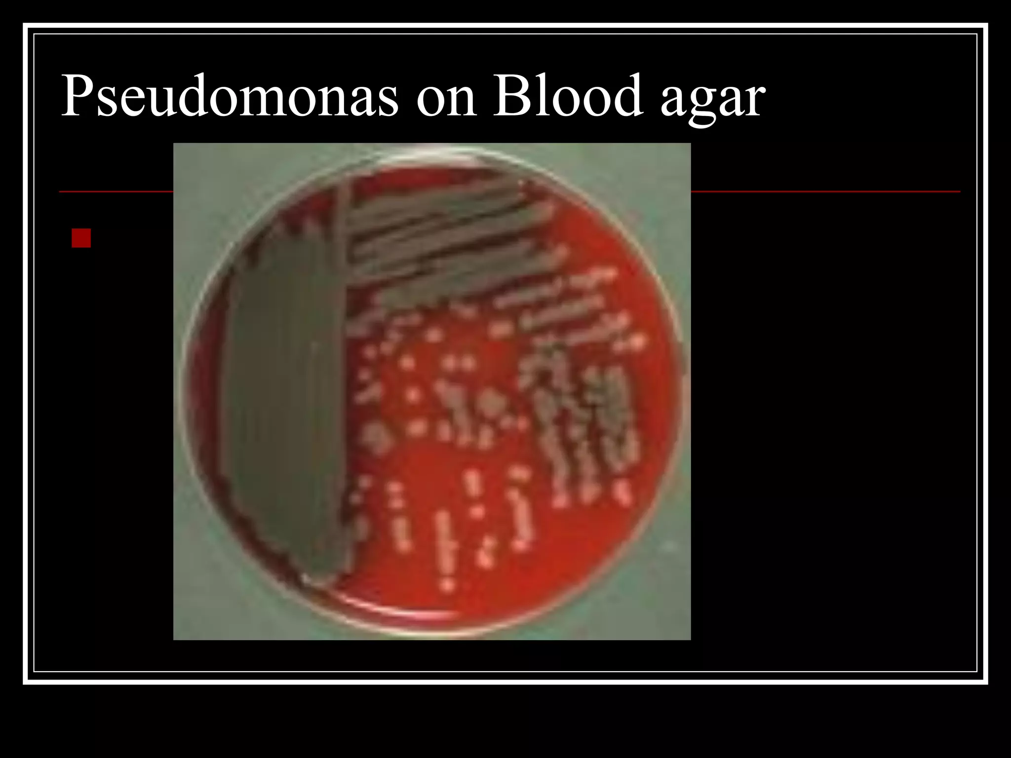 Pseudomonas mahadippt | PPT