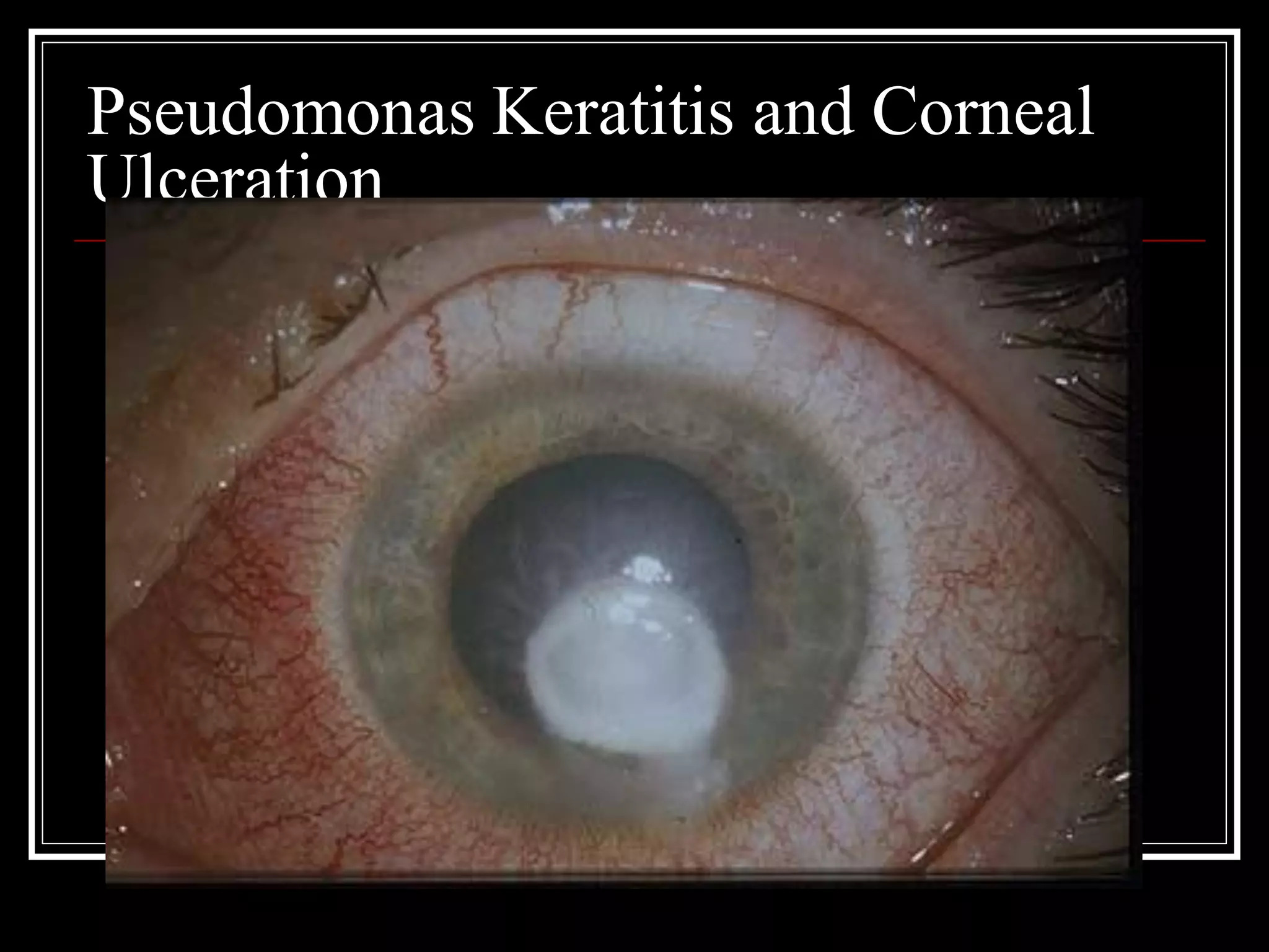 Pseudomonas mahadippt | PPT
