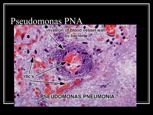 Pseudomonas mahadippt | PPT