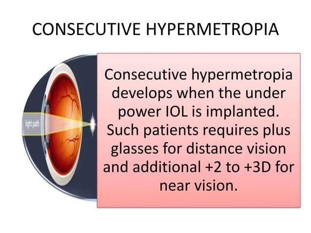 Pseudophakia | PPTX | Eye and Vision Conditions | Diseases and Conditions