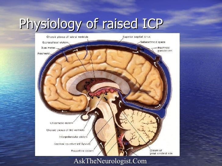 Pseudotumor Cerebri (Idiopathic intracranial hypertension)