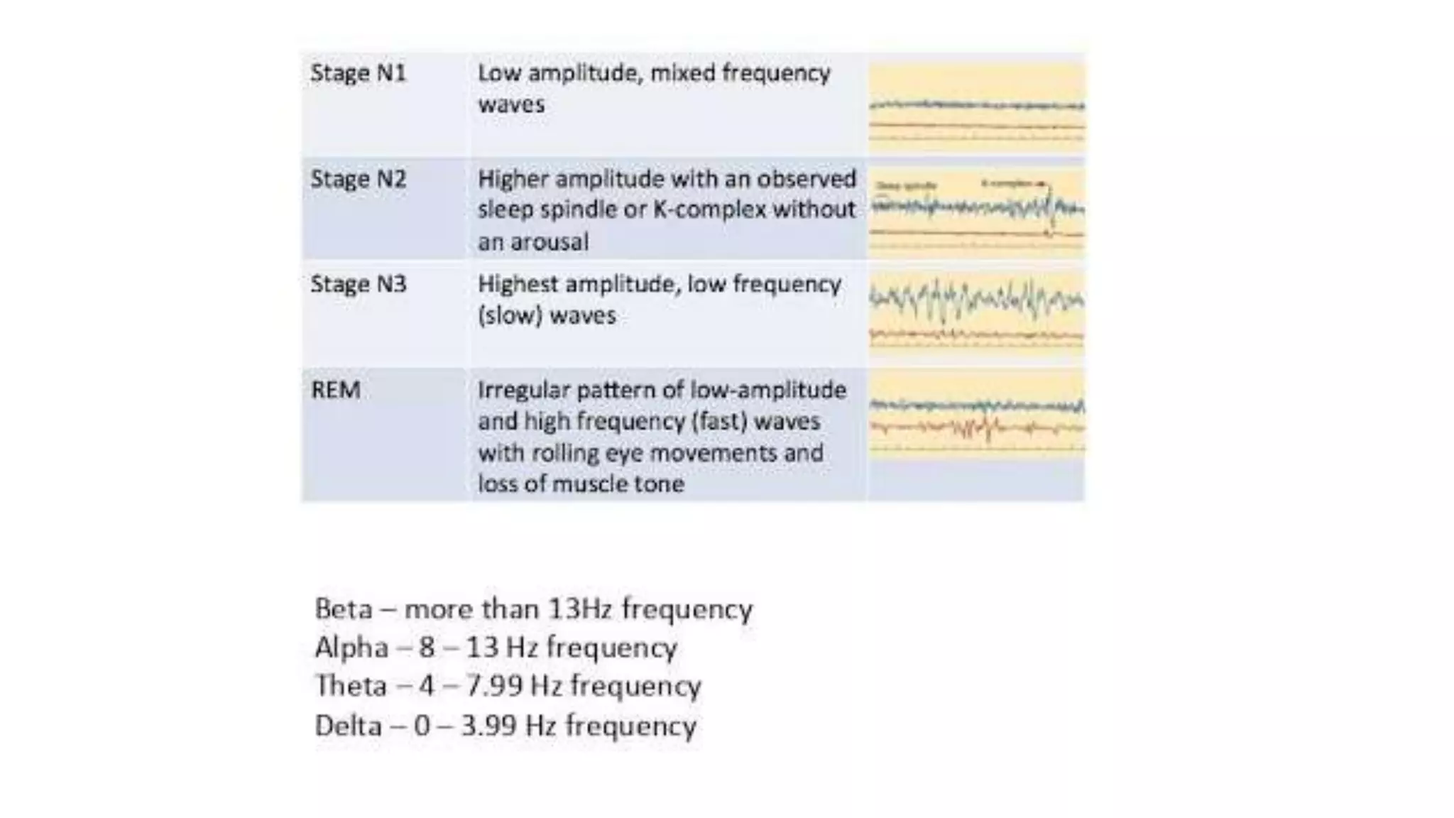 Pediatric Polysomnography (Sleep study) | PPTX