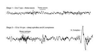 Pediatric Polysomnography (Sleep study) | PPTX