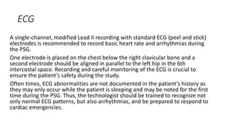 Polysomnography and its parameters- a complete overview. | PPT