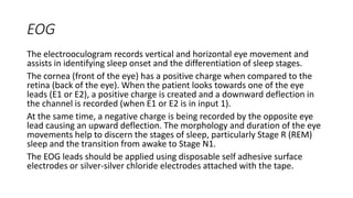 Polysomnography and its parameters- a complete overview. | PPT
