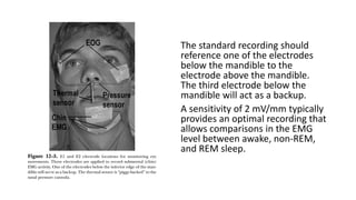 Polysomnography and its parameters- a complete overview. | PPT