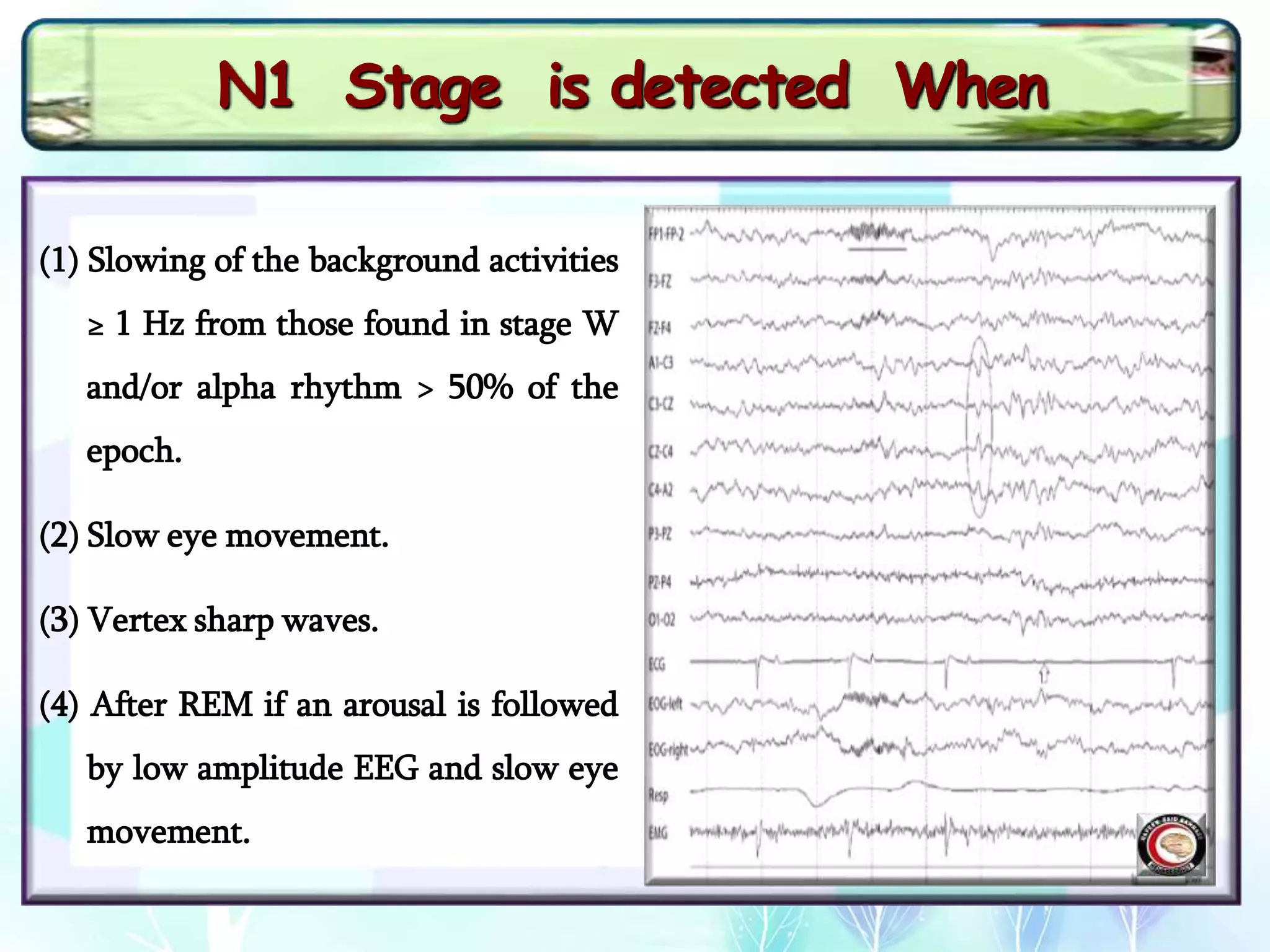 Polysomnogram interpretetion | PPTX