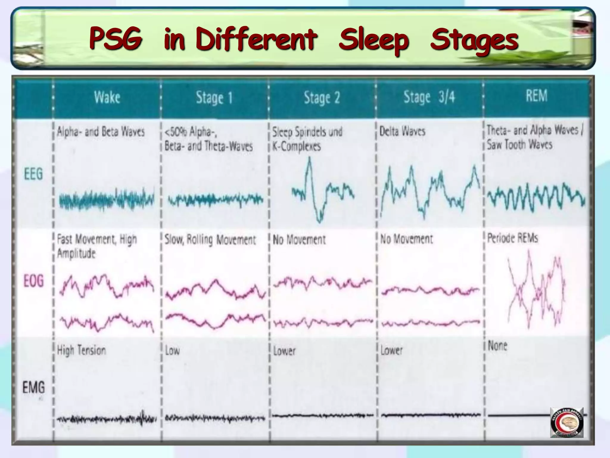 Polysomnogram interpretetion | PPTX