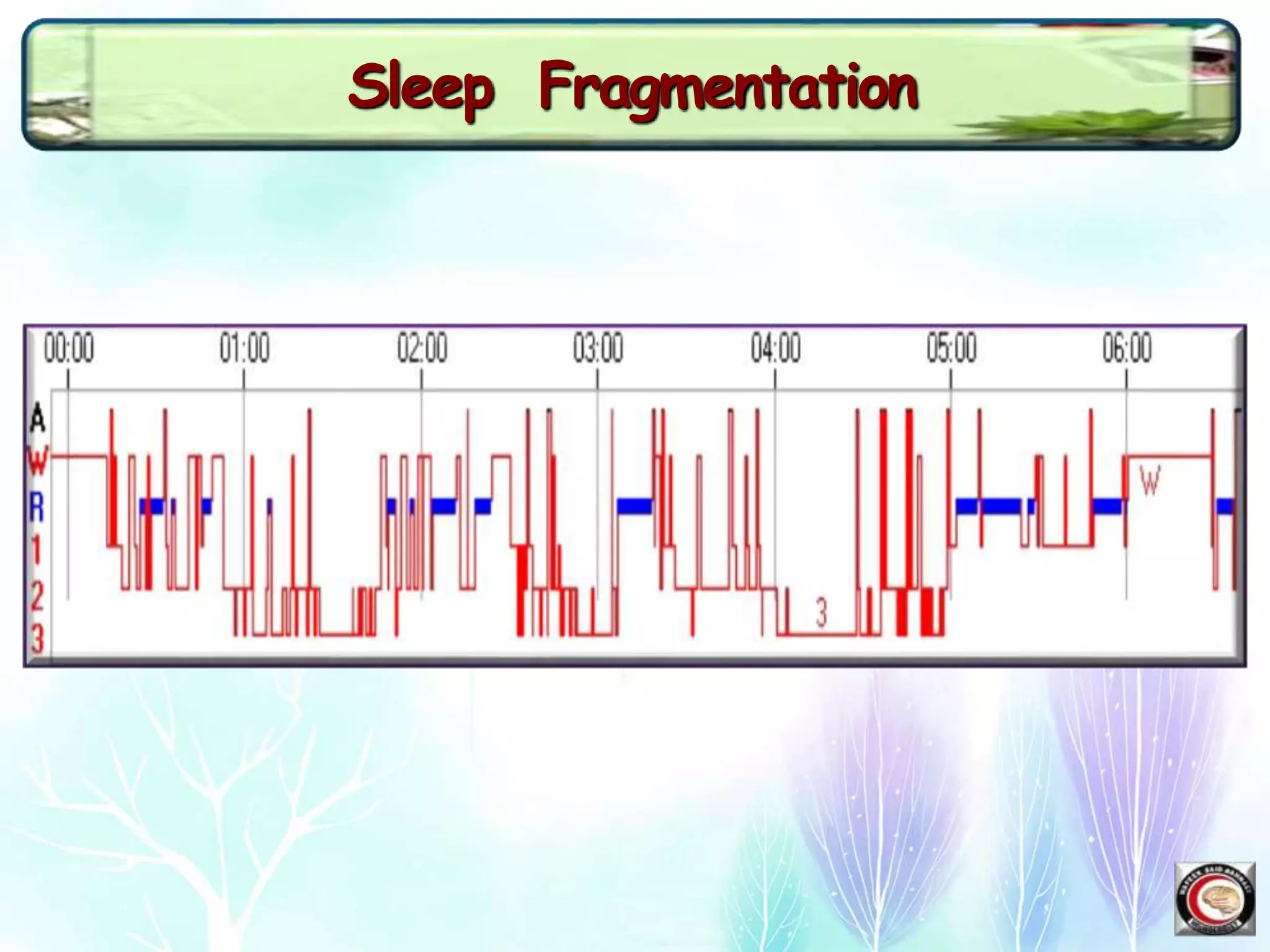 Polysomnogram interpretetion | PPTX